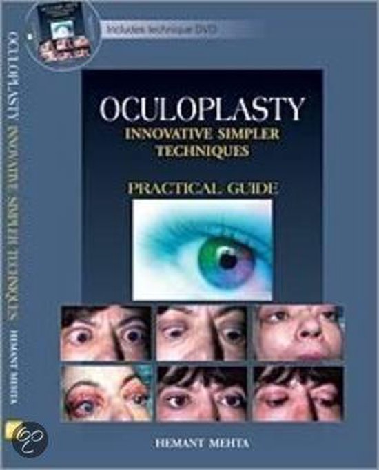 Oculoplasty, Hemant Mehta | 9788192112305 | Boeken | bol