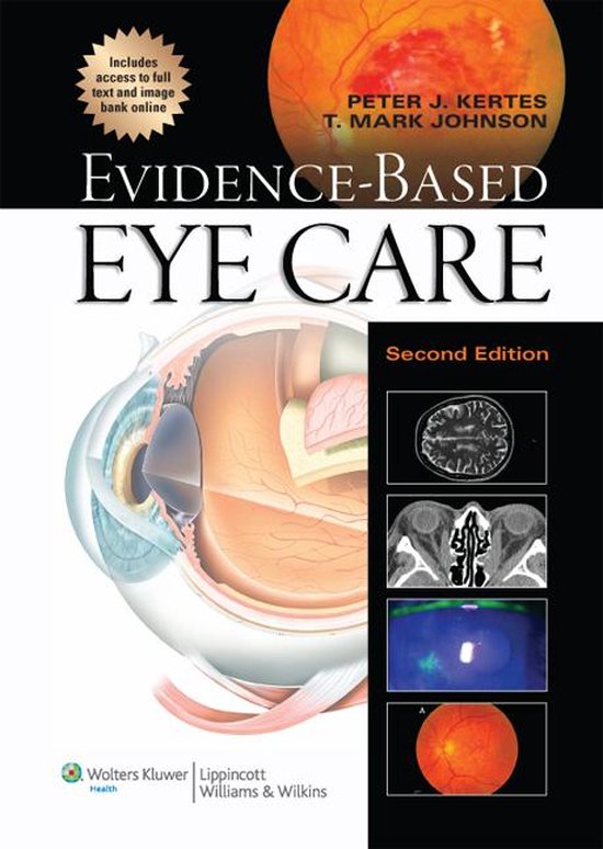 Evidence-Based Eye Care (ebook), Peter J. Kertes | 9781469838090 ...