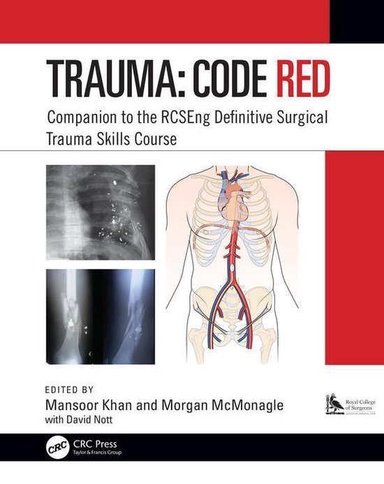 Trauma: Code Red (ebook) | 9781351105620 | Boeken | bol.com