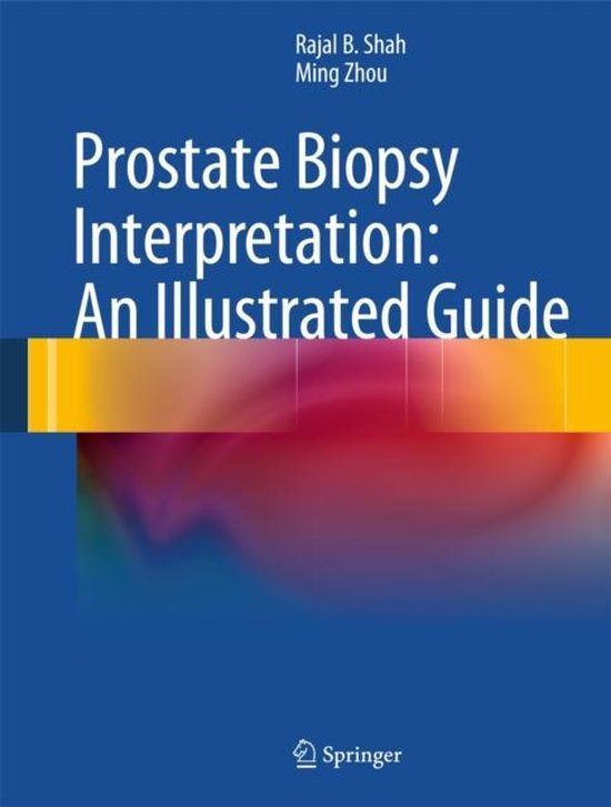 Prostate Biopsy Interpretation, Rajal B. Shah | 9783642213687 | Boeken ...