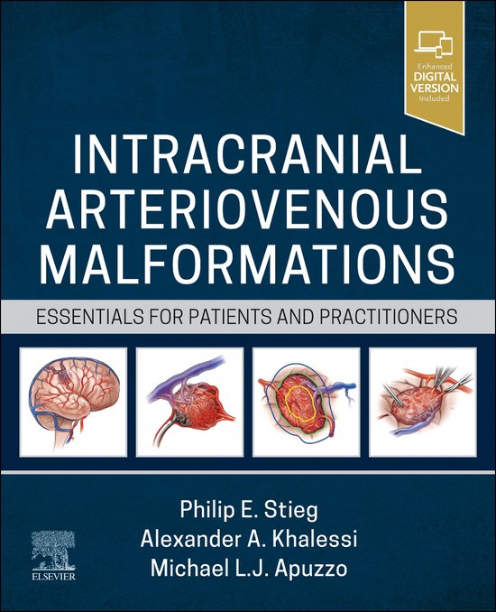 Intracranial Arteriovenous Malformations | 9780323825306 | Philip E ...