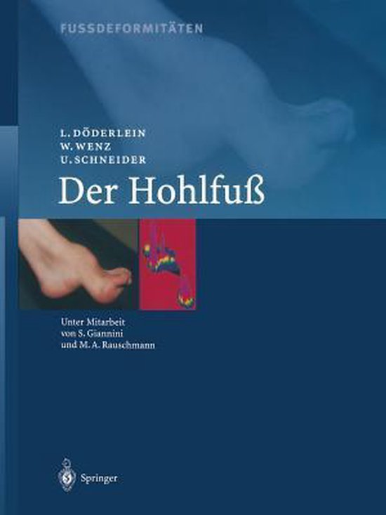 Fussdeformitäten | 9783642630996 | L Doederlein | Boeken | bol.com