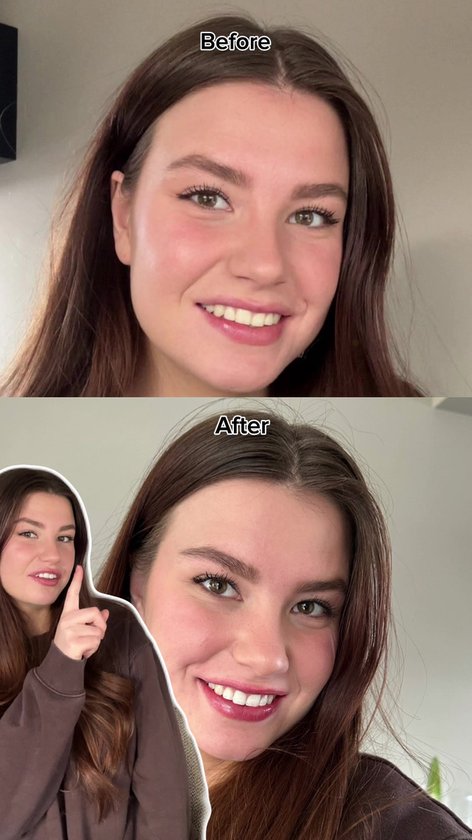 Vimora Teeth Whitening Strips – Tandenbleken – Tanden Bleken ...