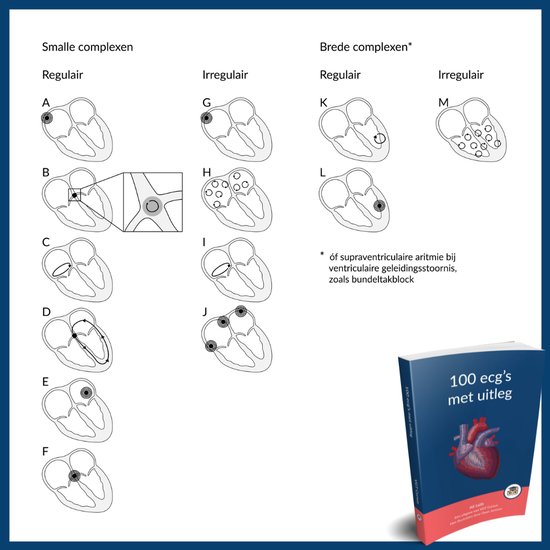 100 ecg's met uitleg - Hét ECG-boek van 2021 - Kraakheldere ...