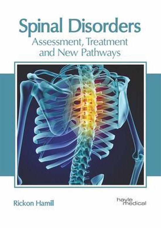 Spinal Disorders: Assessment, Treatment and New Pathways ...