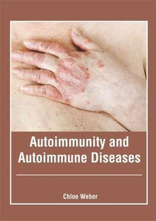 Autoimmunity and Autoimmune Diseases | 9781632426871 | Boeken | bol.com