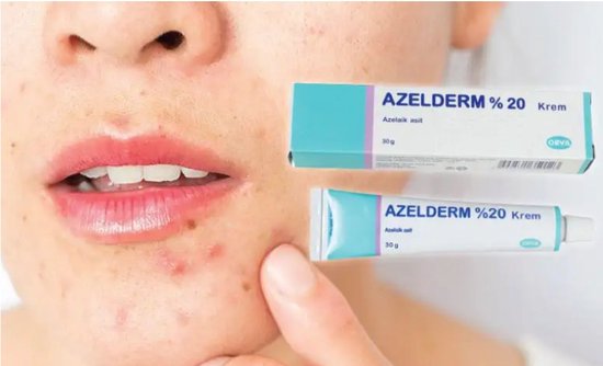 Azelderm %20 - Crème - Behandeling van Acné + Schimmels & Eczeem - Bekend Product | bol