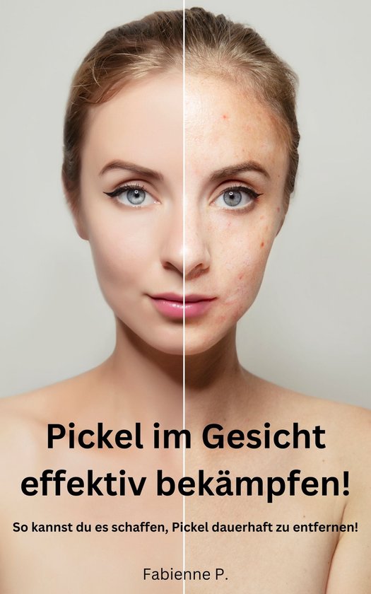 Pickel im Gesicht effektiv bekämpfen! (ebook), Fabienne P ...