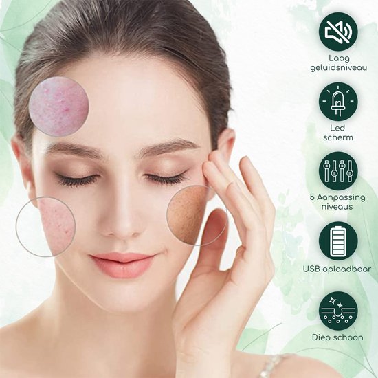 Royal WM - Pro - Blackhead Remover - Mee Eters Verwijderaar ...