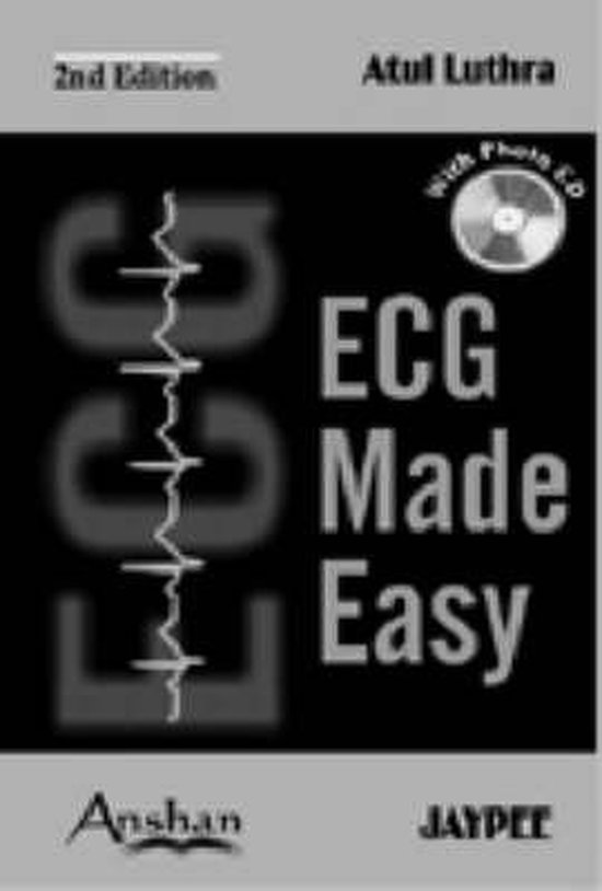 ECG MADE EASY | 9781904798217 | Atul Luthra | Boeken | bol