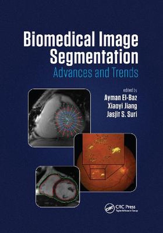 Biomedical Image Segmentation | 9780367870867 | Boeken | bol.com