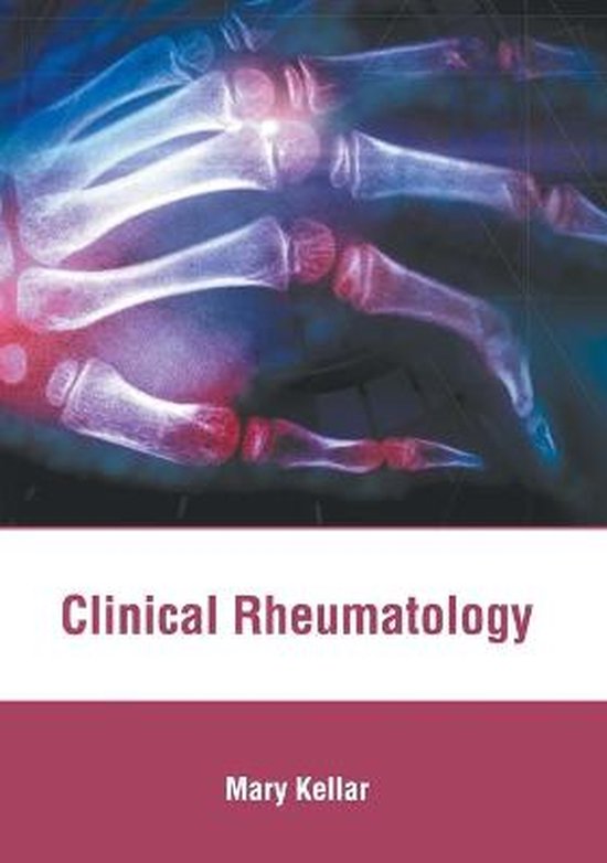 Clinical Rheumatology | 9781639274741 | MARY KELLAR | Boeken | bol
