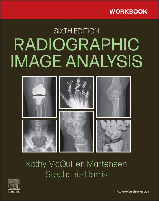 Workbook for Radiographic Image Analysis | 9780323930680 | Kathy ...