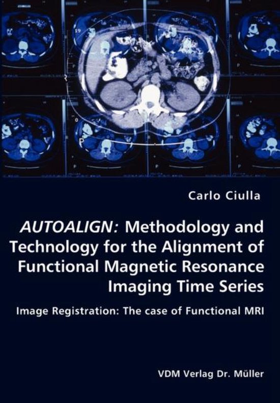 Autoalign, Carlo Ciulla | 9783836437288 | Boeken | bol