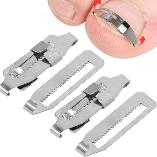 Ingegroeide Teennagel Corrector 2 Stuks - Paronychia Correctie - Rvs ...