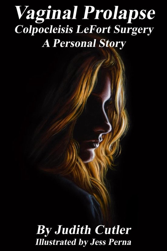 Vaginal Prolapse Colpocleisis LeFort Surgery A Personal Story (ebook ...