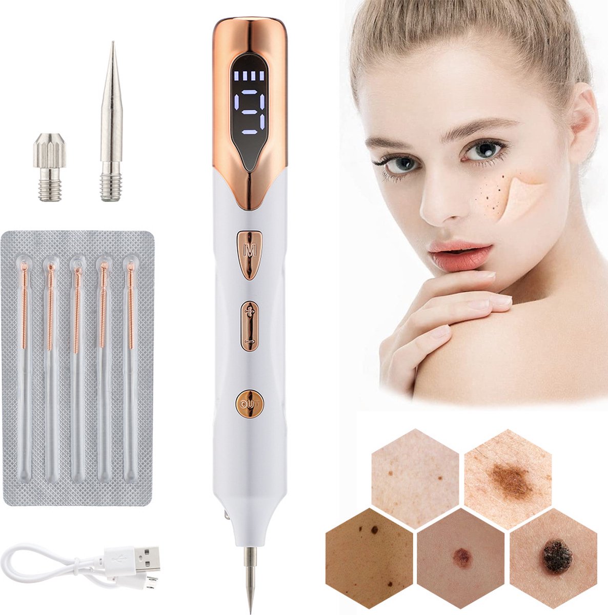Laser Plasma Pen - Wit/Roze/Goud - Huidverzorging - Gezicht behandeling ...