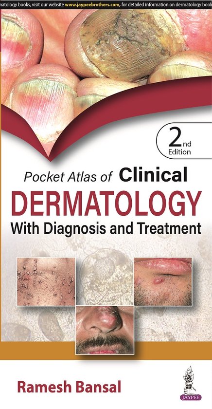 Pocket Atlas of Clinical Dermatology with Diagnosis and Treatment, Ramesh Bansal |... | bol