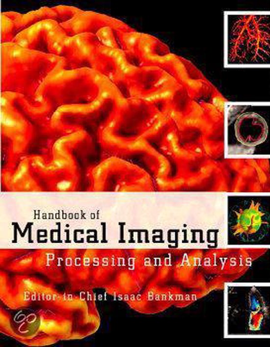 Handbook Of Medical Imaging | 9780120777907 | Isaac Bankman | Boeken | bol