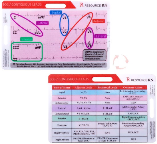 Elektrocardiogram Badge Card - Compact EKG Cheat Sheet - Voor ...