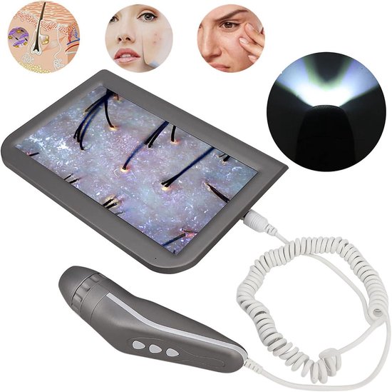 Hair & Skin Analysis Machine - Hoofdhuid & haar diagnose - 50X & 200X ...
