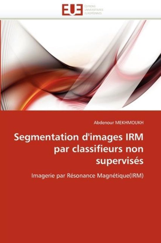 Segmentation d'images IRM par classifieurs non supervisés, Mekhmoukh-A | 9786131571800... | bol.com