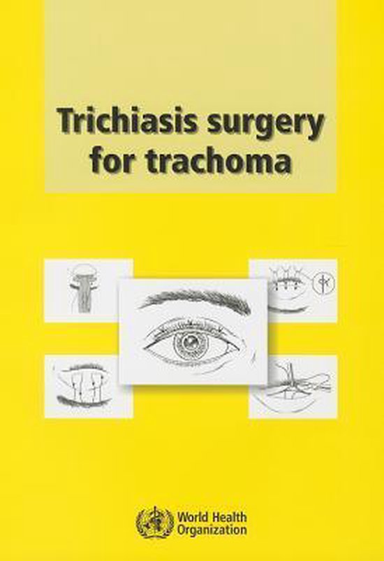 Trichiasis surgery for trachoma | 9789241548670 | World Health ...