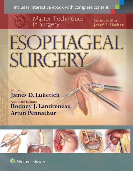 Master Techniques In Surgery Master Techniques In Surgery Esophageal