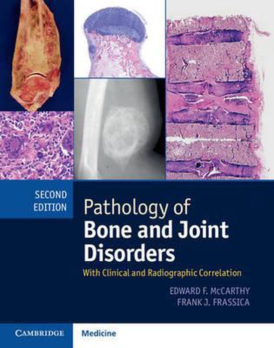 Pathology Of Bone & Joint Disorders | bol.com