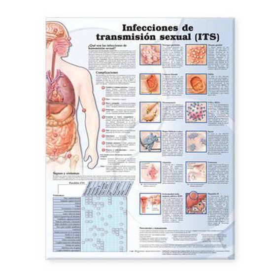 Sexually Transmitted Infections Anatomical Chart in Spanish (Infecciones de... | bol.com
