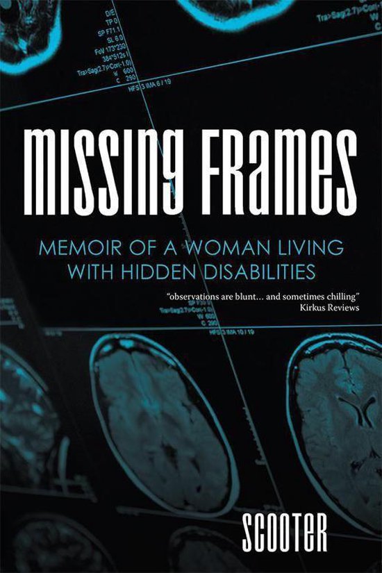 Missing Frames (ebook), Scooter | 9781504926553 | Boeken | bol