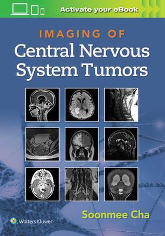 Imaging of Central Nervous System Tumors | 9781975103743 | Soonme Cha | Boeken | bol.com