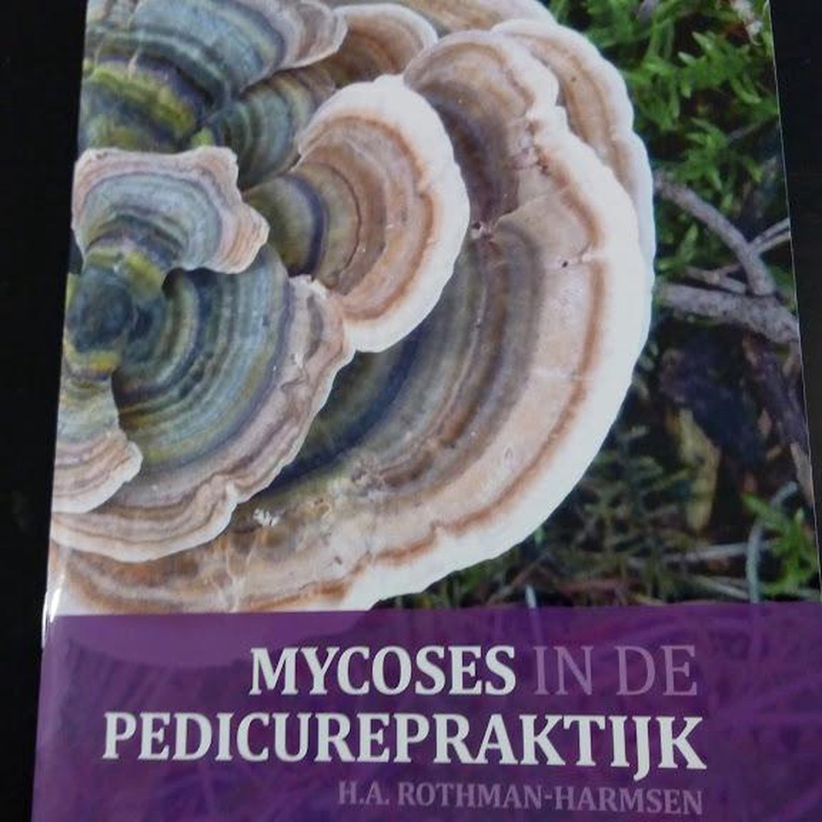 Mycoses in de pedicurepraktijk (vakboek voor pedicures) | 9789082161052 ...