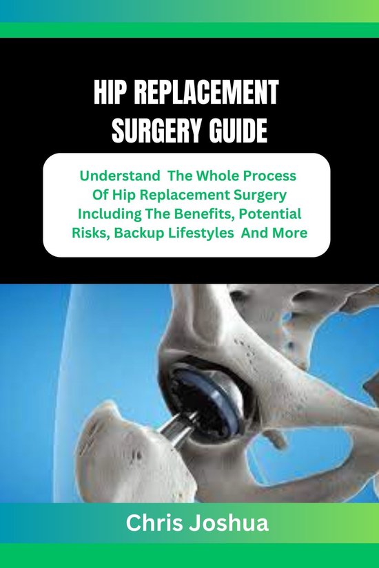 HIP REPLACEMENT SURGERY GUIDE (ebook), Chris Joshua | 1230006402785 ...