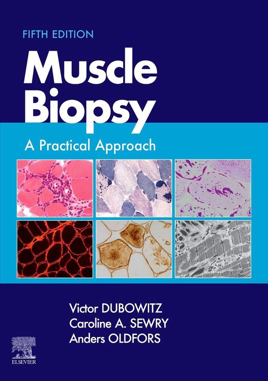 Muscle Biopsy E-Book (ebook), Victor Dubowitz, Md, Phd, Frcp, Frcpch ...
