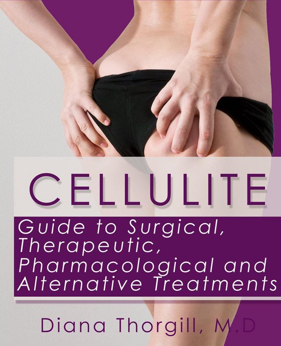 Cellulite: Guide to Surgical, Therapeutic, Pharmacological and Alternative Treatments... | bol.com