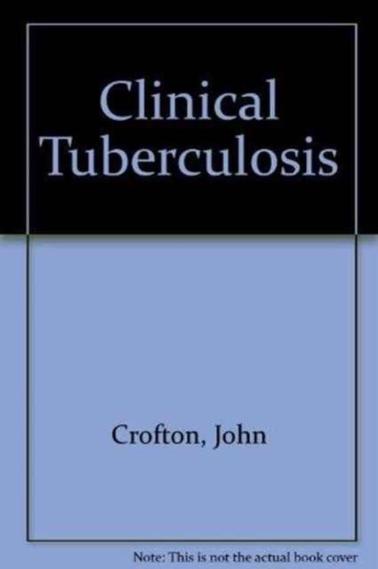 Clinical Tuberculosis | 9780333724309 | John Crofton | Boeken | bol.com