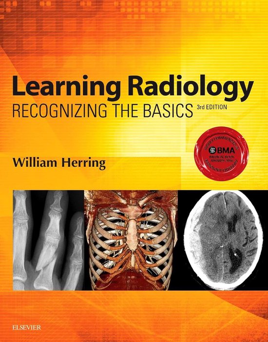 Learning Radiology E-Book (ebook), William Herring, Md, Facr ...