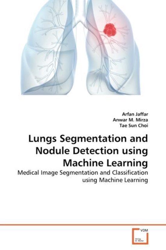 Lungs Segmentation and Nodule Detection using Machine Learning ...