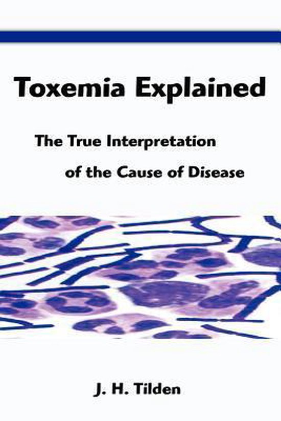Toxemia Explained, John H. Tilden | 9781599869186 | Boeken | bol.com