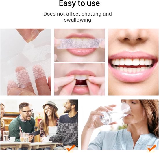 Tanden bleken | Tandenbleekset | Witte tanden | Tandenblekers | Tanden ...