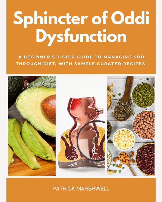 Sphincter of Oddi Dysfunction (ebook), Patrick Marshwell ...