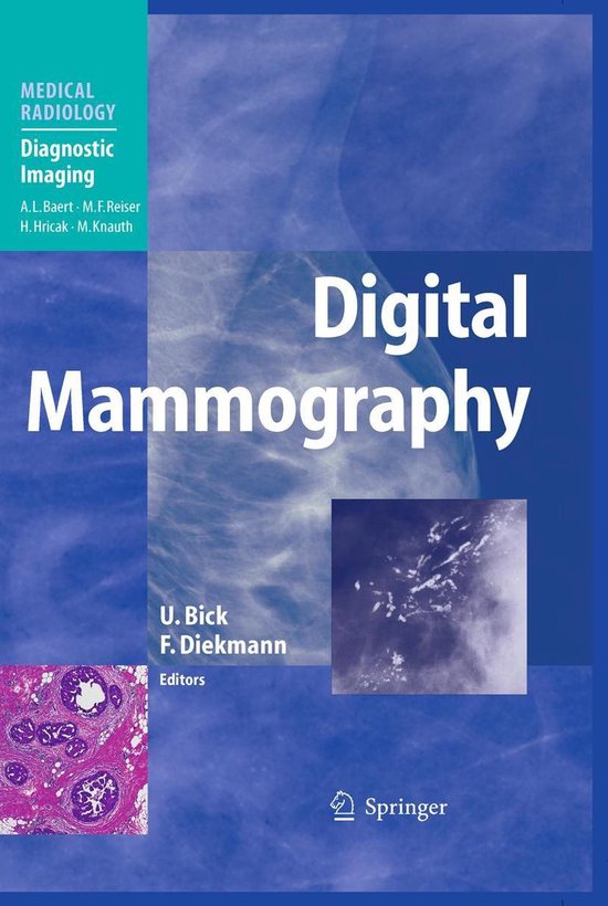 Medical Radiology - Digital Mammography (ebook) | 9783540784500 ...
