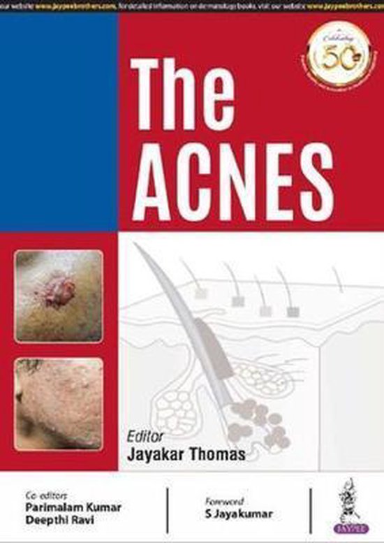 The Acnes, Jayakar Thomas | 9789352703579 | Boeken | bol.