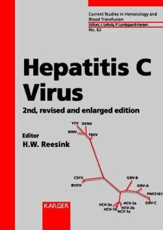 Hepatitis C Virus | 9783805565424 | Boeken | bol.com