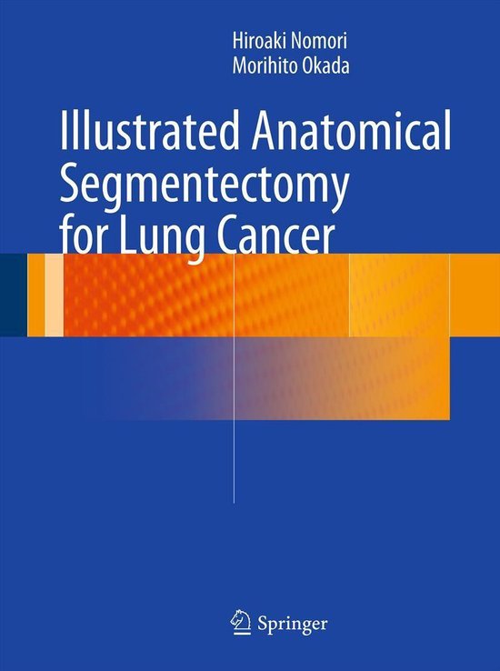 Illustrated Anatomical Segmentectomy For Lung Cancer Ebook Hiroaki Nomori