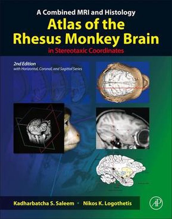 A Combined MRI and Histology Atlas of the Rhesus Monkey Brain in ...