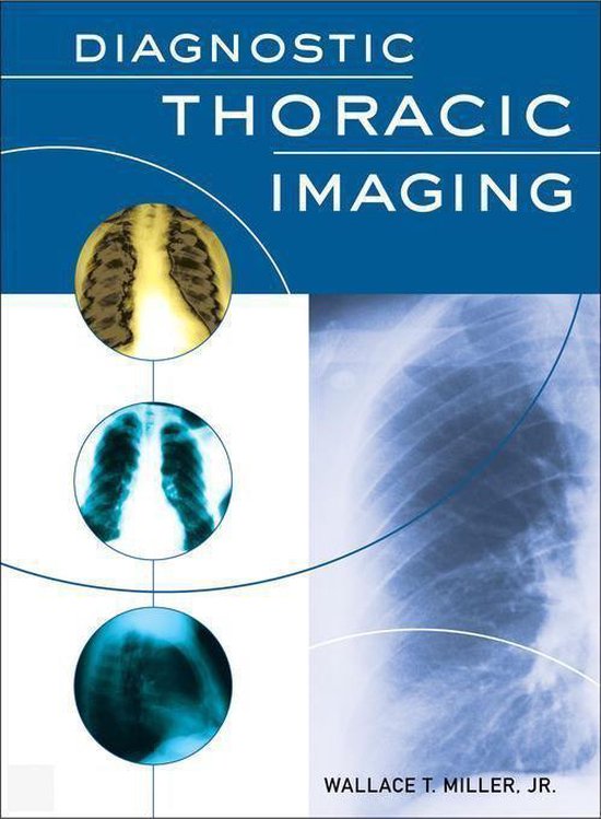 Diagnostic Thoracic Radiology (ebook), Wallace Miller | 2370004340166 ...