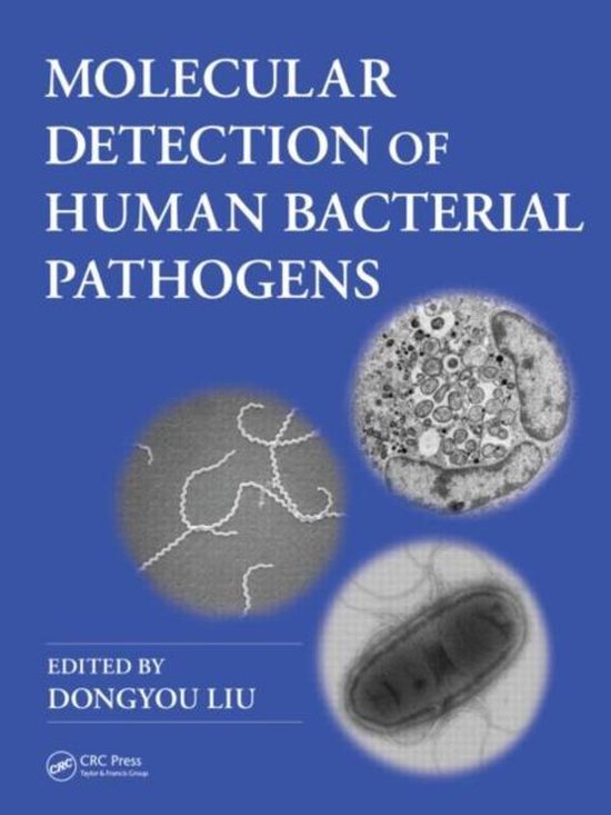 Molecular Detection of Human Bacterial Pathogens | 9781439812389 ...