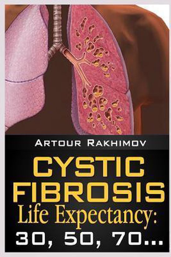 Cystic Fibrosis Life Expectancy, Artour Rakhimov | 9781478186892 ...